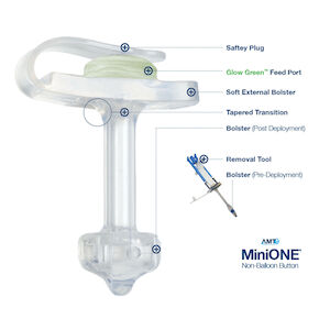 14 Fr, 2.5 cm, Non-Balloon Button Gastrostomy Tube | Preferred Medical