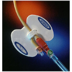 StatLock Foley Stabilization Device - Latex Catheter | Preferred Medical