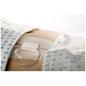 Cath-Secure Extended Tab Foley and Multi-Purpose Tube Securement Device ...