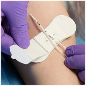 CVC, PICC and Drain Securement Device - Navilyst Xcela | Preferred Medical