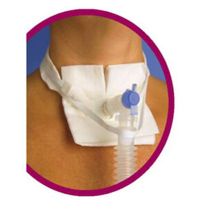 TRACH TUBE HOLD VENT ANTI DIS CONNECT 20 | Preferred Medical